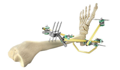 Hoffmann 3 | Stryker